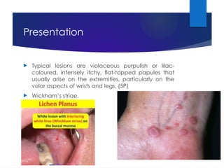 Papulosquamous Disorders including psoriasis, lichen planus, pityriasis ...