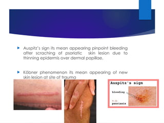 Papulosquamous Disorders including psoriasis, lichen planus, pityriasis ...