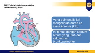 papvd partial anomalous pulmonary vein drainage.pptx