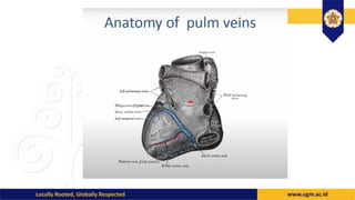 papvd partial anomalous pulmonary vein drainage.pptx