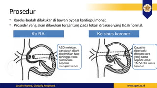 papvd partial anomalous pulmonary vein drainage.pptx