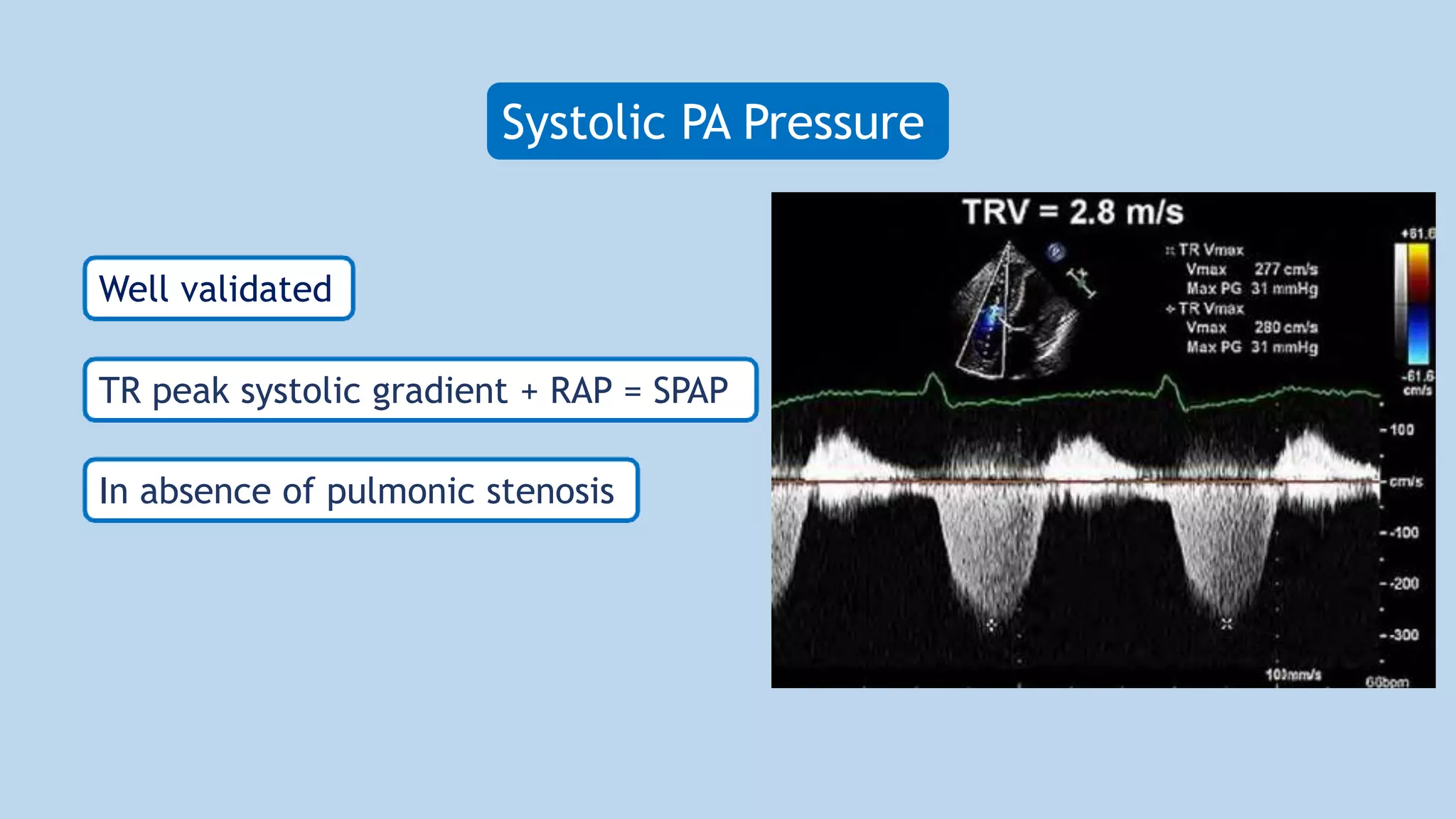 Non-invasive haemodynamic monitoring by Echocardiography | PPTX