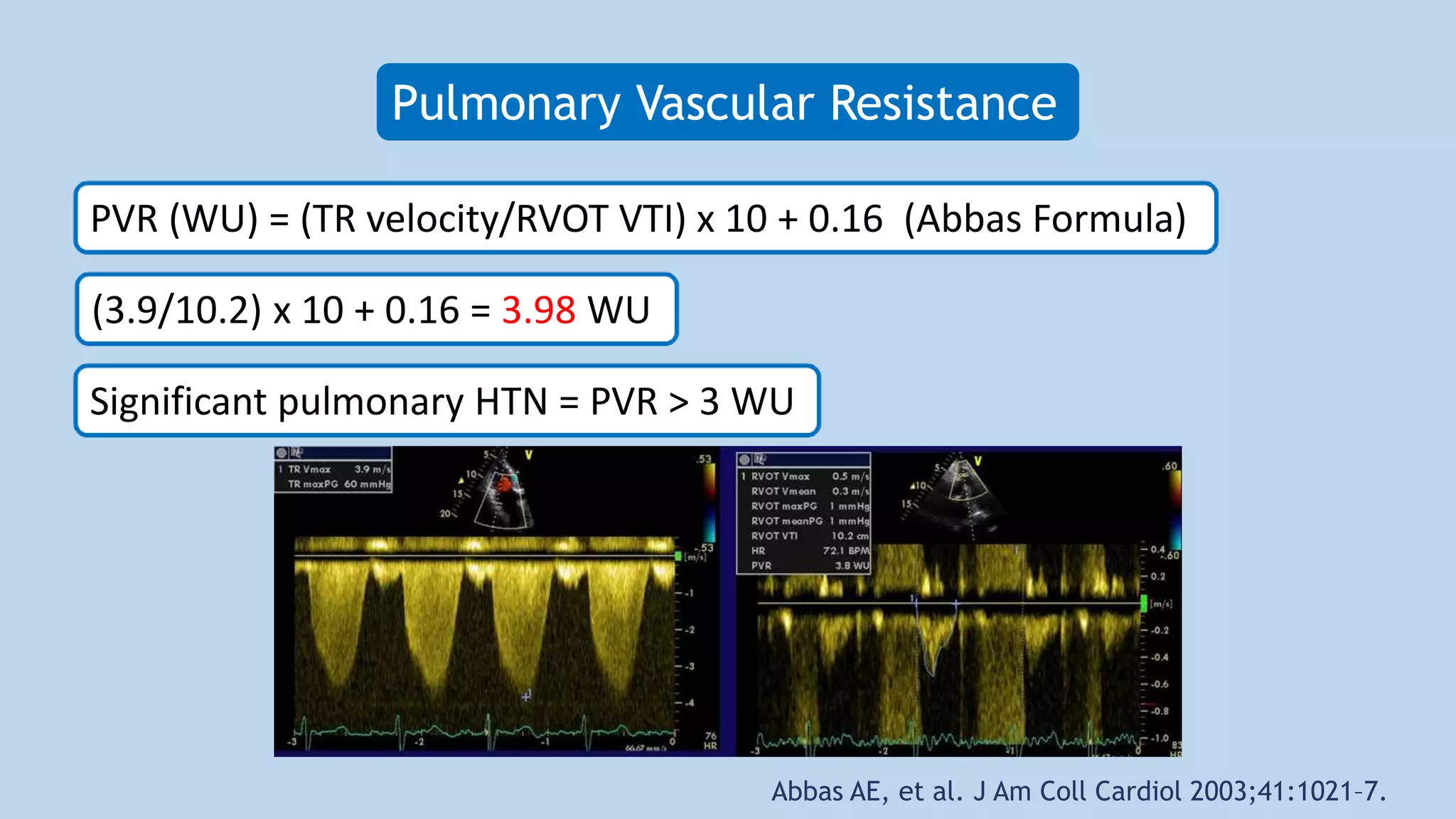 Non-invasive haemodynamic monitoring by Echocardiography | PPTX