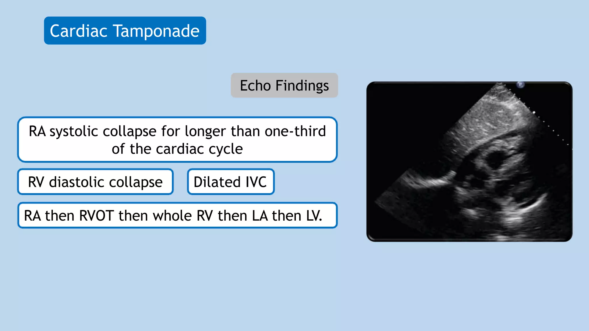 Non-invasive haemodynamic monitoring by Echocardiography | PPTX
