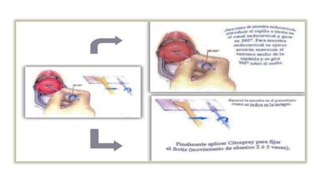 Pap y tecnica correcta