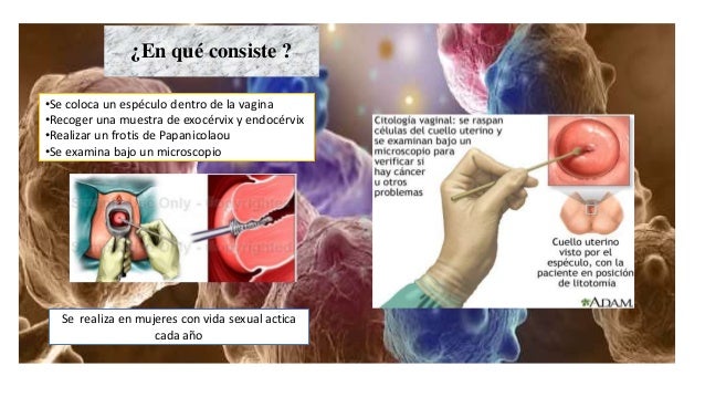 Pap y tecnica correcta