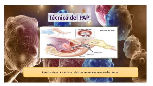 Pap y tecnica correcta
