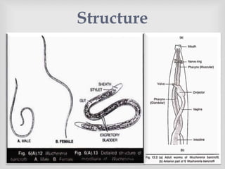 NTDs - Lymphatic filariasis | PPTX