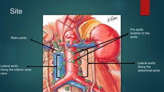 Para-aortic lymphatic drainage | PPTX