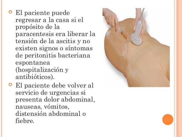 Paracentesis