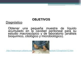 Paracentesis | PPTX