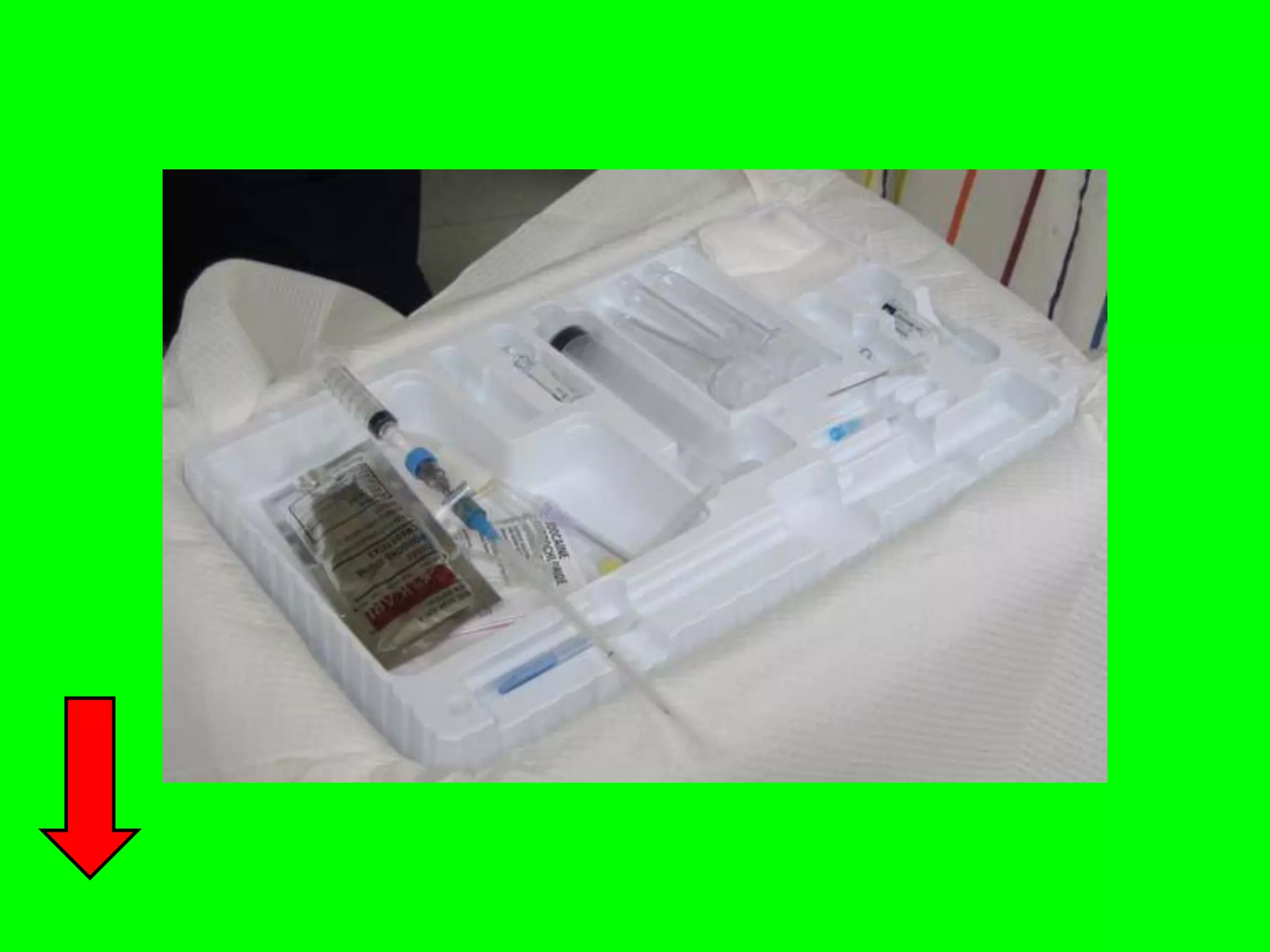 Paracentesis | PDF | Digestive Disorders | Diseases and Conditions