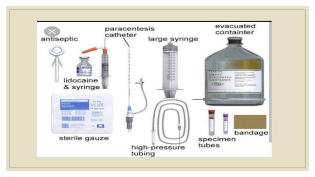 Paracentesis | PPTX