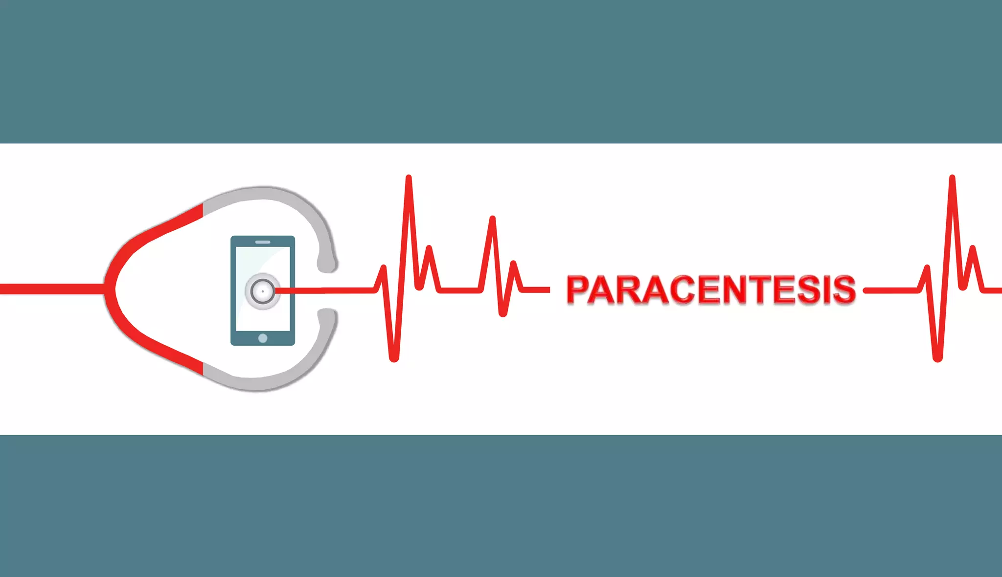 Paracentesis.pptx