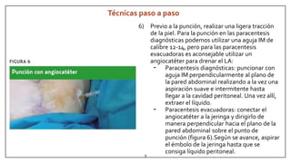 Paracentesis.pdf