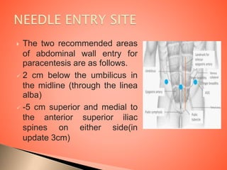 PARACENTESIS.pptx | Digestive Disorders | Diseases and Conditions