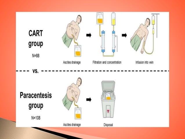 PARACENTESIS.pptx | Digestive Disorders | Diseases and Conditions