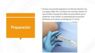 PARACENTESIS DIAGNOSTICO, TRATAMIENTO.pdf