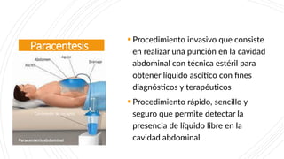 PARACENTESIS DIAGNOSTICO, TRATAMIENTO.pdf