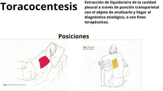 Toracocentesis y Paracentesis en Urgencias | PDF