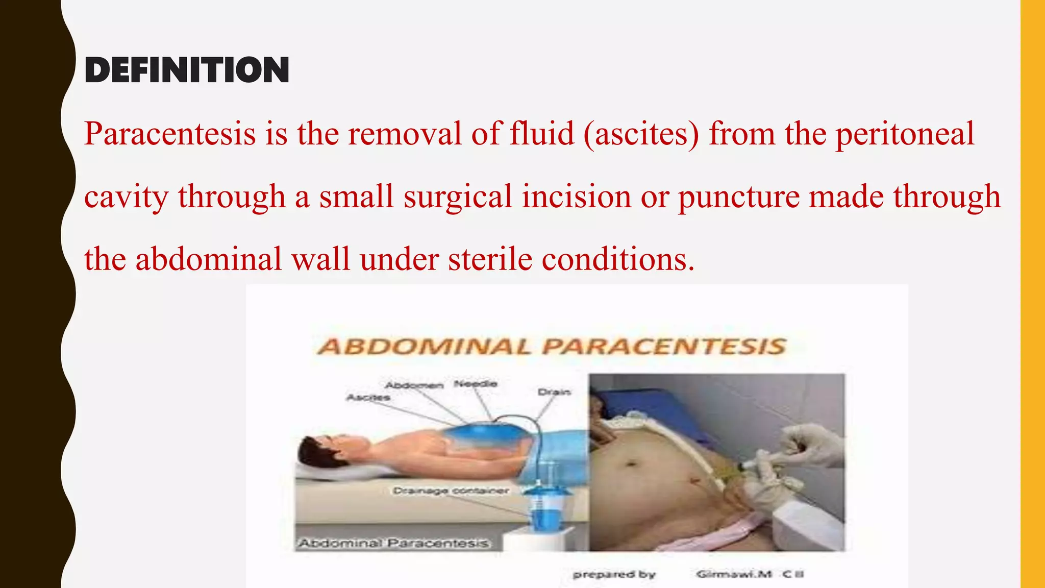 Paracentesis | PPTX