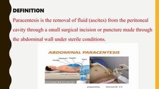 Paracentesis | PPTX