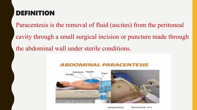 Paracentesis | PPTX | First Aid | Injuries