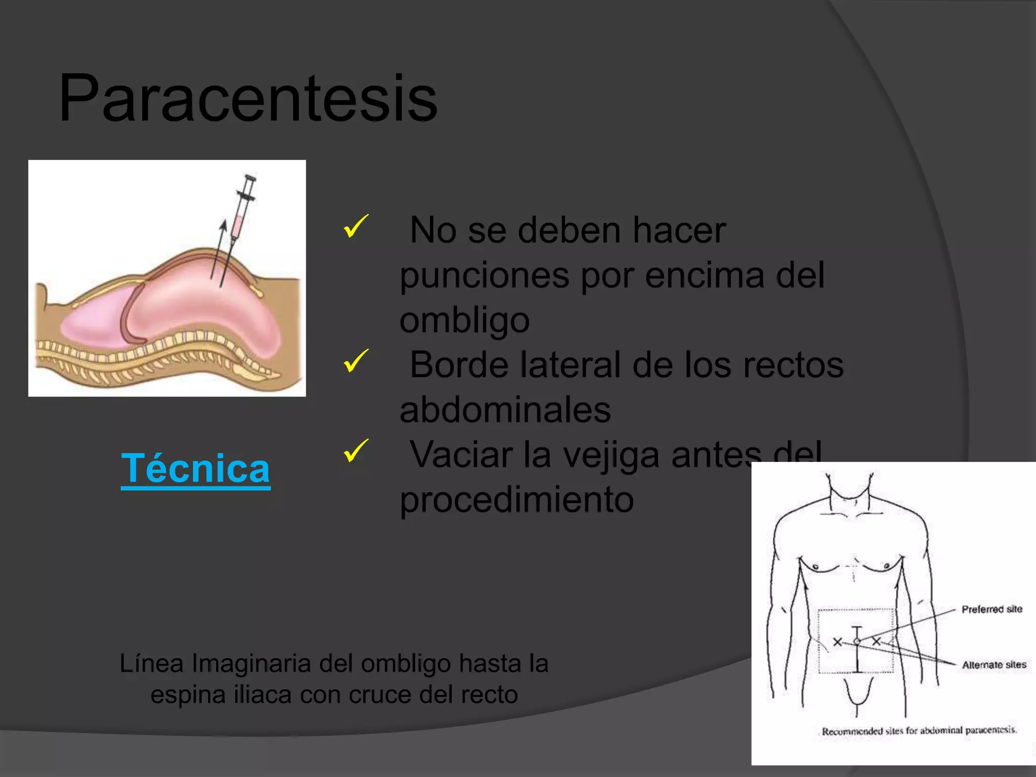 Paracentesis y lavado peritoneal | PPT