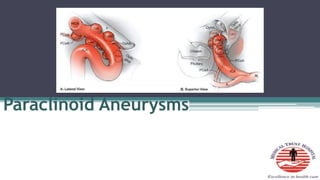 Paraclinoid aneurysms | PPTX