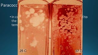 Paracoccidioides | PPT