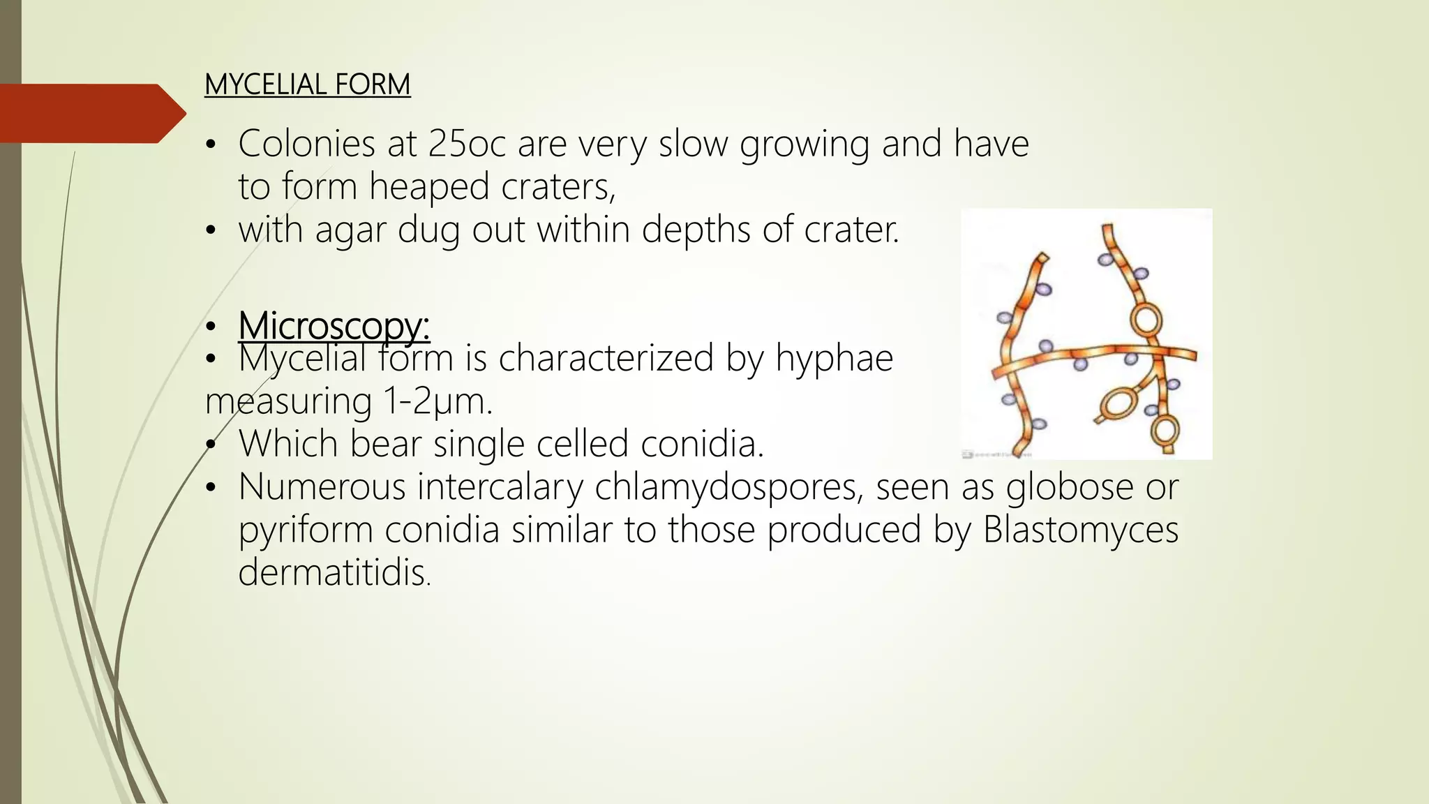 Paracoccidioidomycosis | PPTX