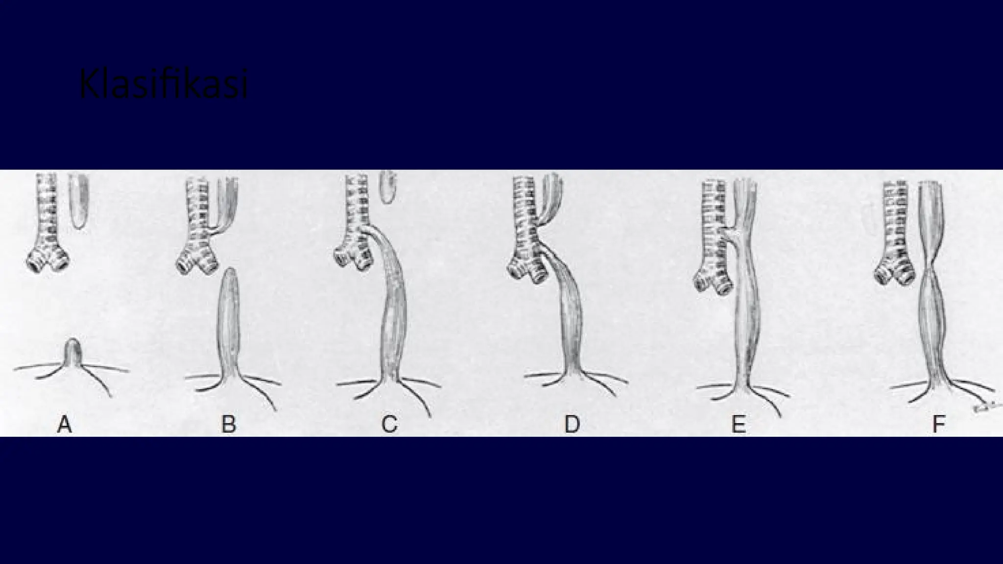 Parade BA 8-8-2024 atresia esofagus _ FIX.pptx
