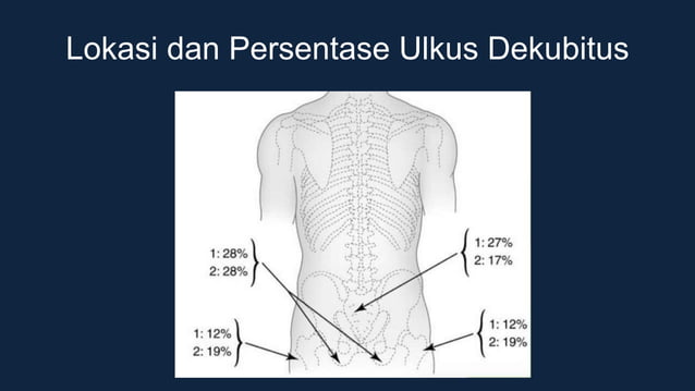 PARADE BEDAH PLASTIK - Ulkus Dekubitus.pptx