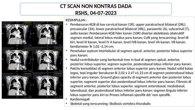 Parade Bedah Thoraks Koeshartati thoraks.pptx