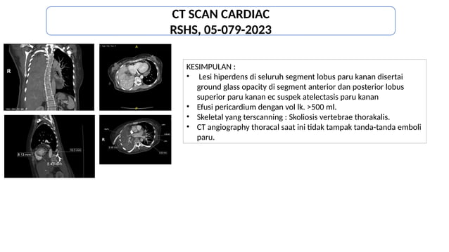 Parade Bedah Thoraks Koeshartati thoraks.pptx