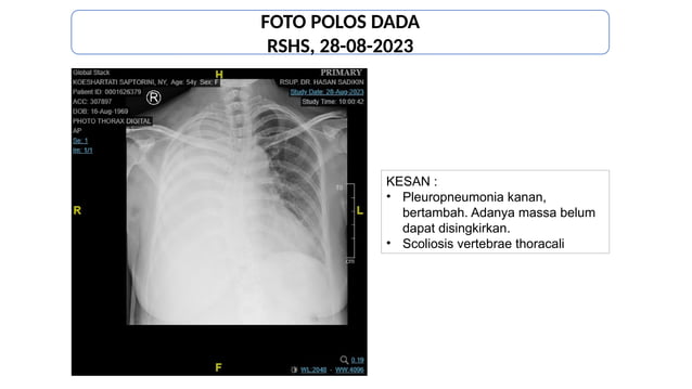 Parade Bedah Thoraks Koeshartati thoraks.pptx