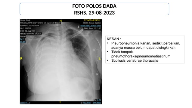 Parade Bedah Thoraks Koeshartati thoraks.pptx | Free Download