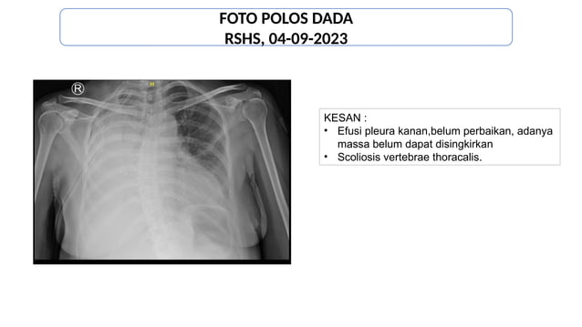 Parade Bedah Thoraks Koeshartati thoraks.pptx