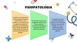 PARAFIMOSIS expo (1).pptx