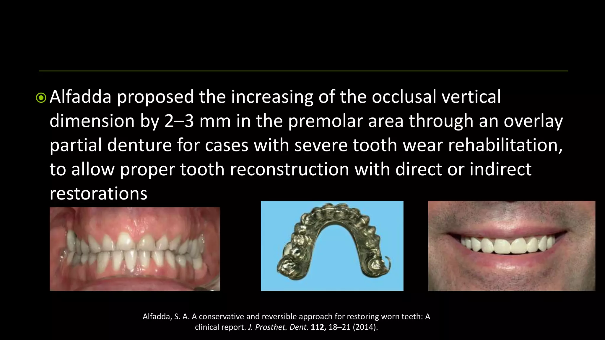 Parafunctional habits in prosthodontics | PPTX