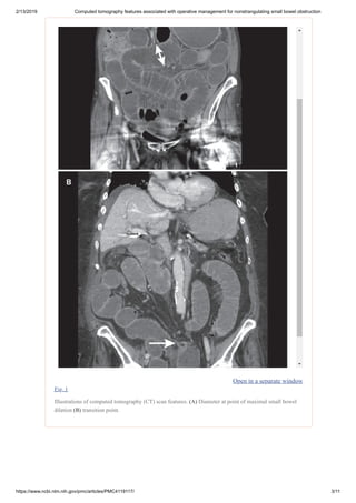 Parag Vora Hamilton Burlington Mcmaster | PDF