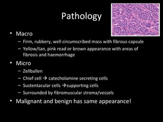 Paraganglioma | PPT