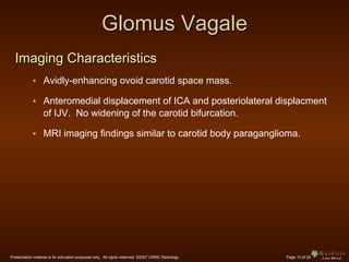 paragangliomas of head and neck FDG PET CT | PDF