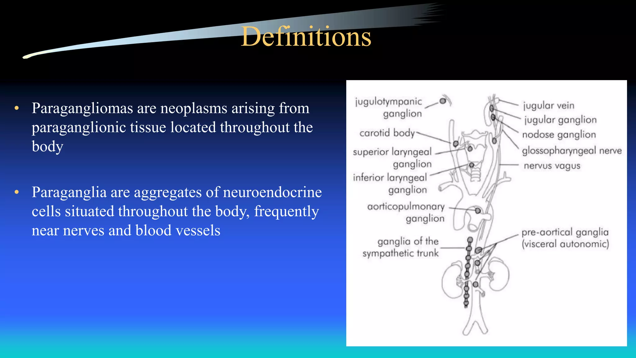 Paragangliomas of head and neck | PPTX
