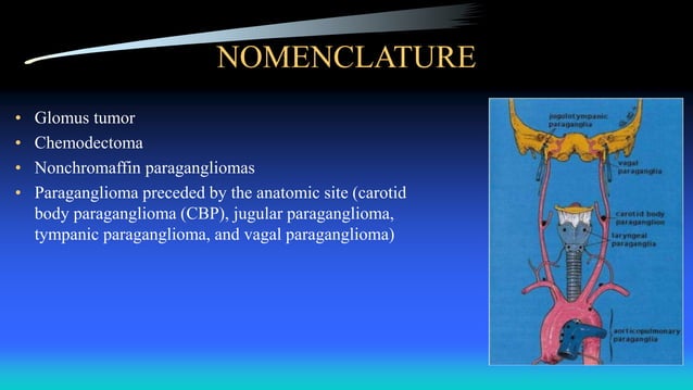 Paragangliomas of head and neck | PPTX | Endocrine and Metabolic ...
