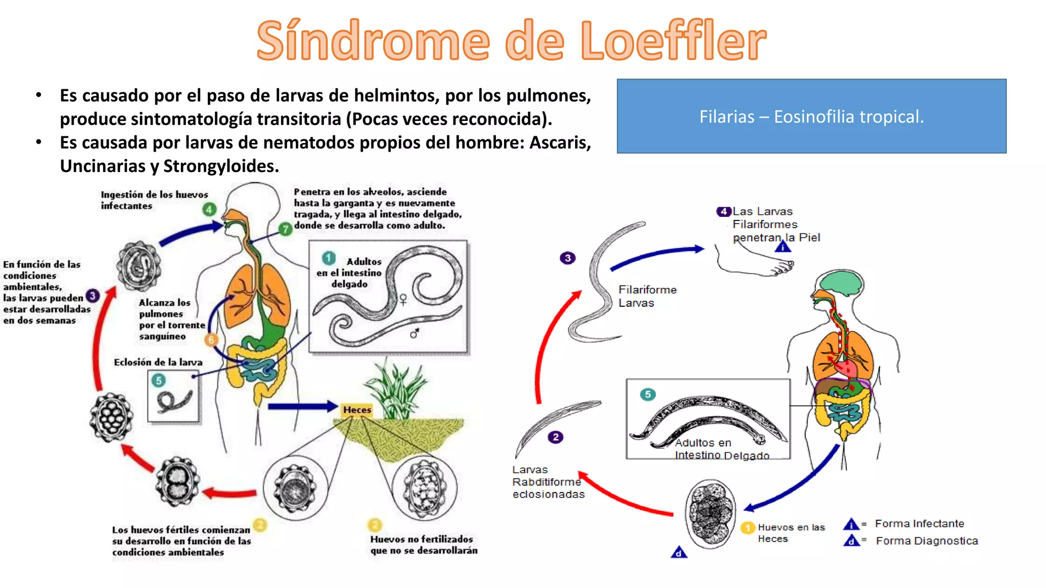 Paragonimiasis Pulmonar - Síndrome de Loeffler | PPTX