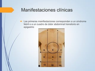 Paragonimosis | PPTX