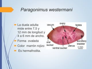 Paragonimosis | PPTX