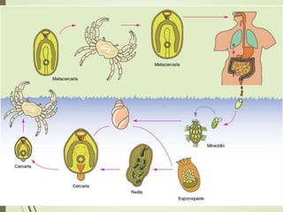Paragonimus (Paragonimiasis)