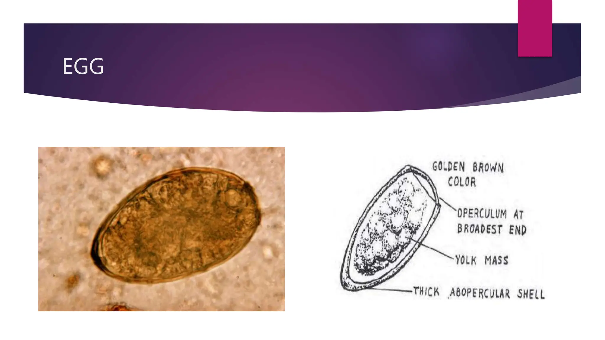 Paragonimus westermani is a parasitic lung fluke primarily found in ...